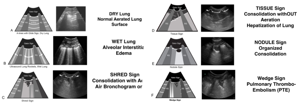 Vet BLUE 6 Lung Signs Horizontal 2018 - IVPOCUS